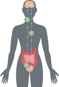 Axonics Neurostimulator Overactive Bladder Treatment
